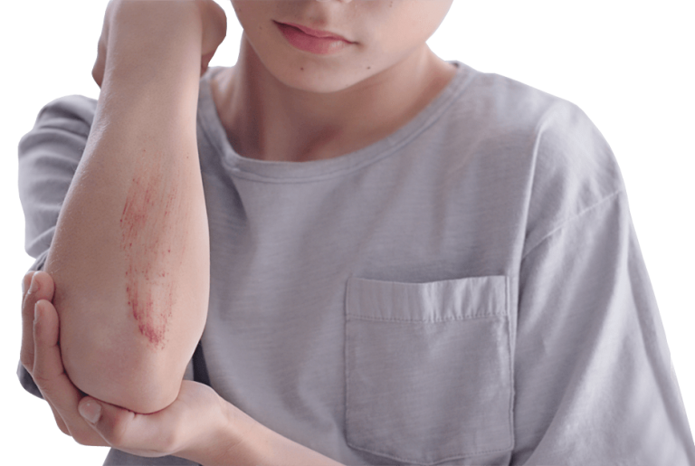 Abrasiones | Neoviderm